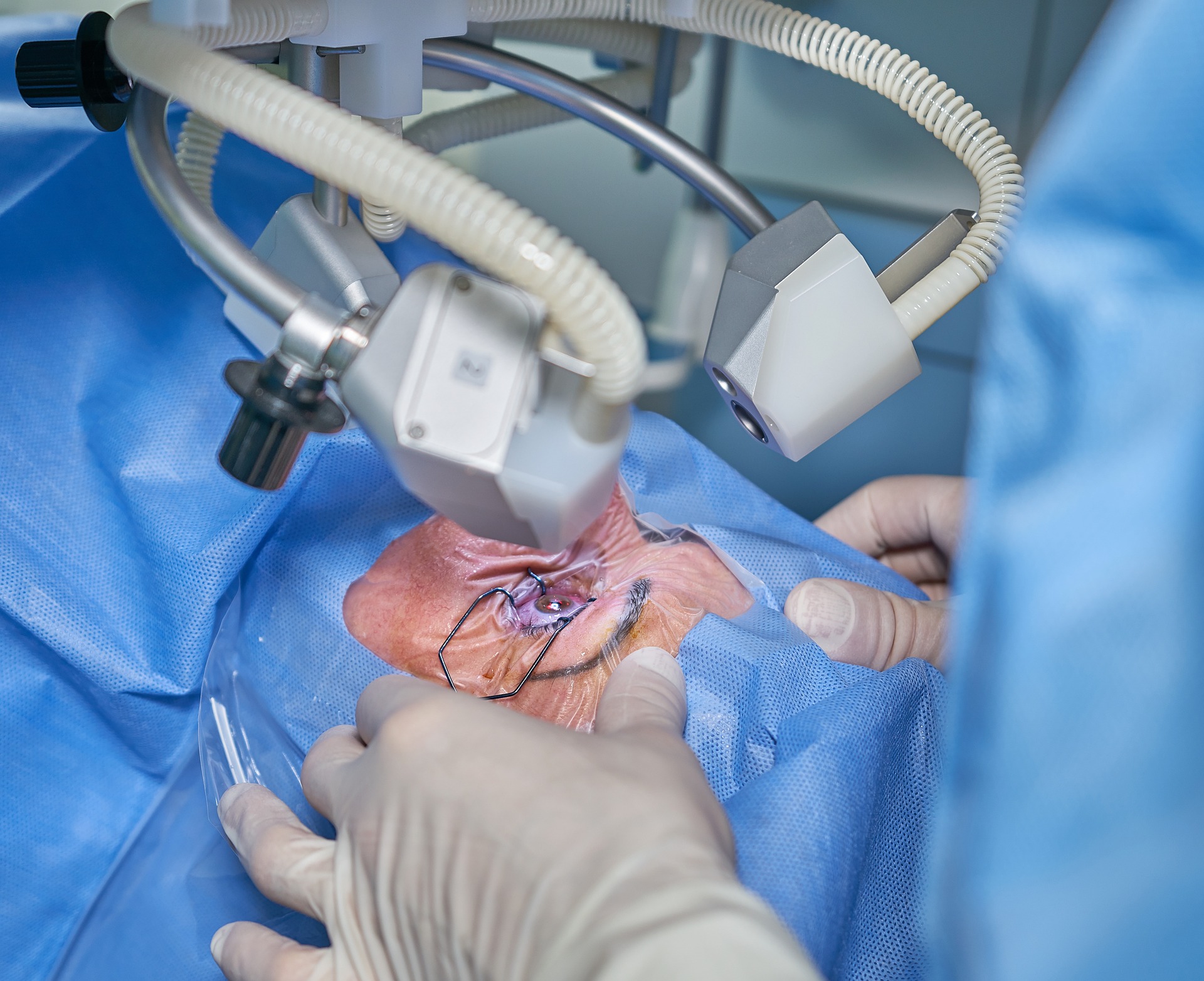 An Eye Specialist In Dubai’s Top Blepharoplasty Post-Op Tips