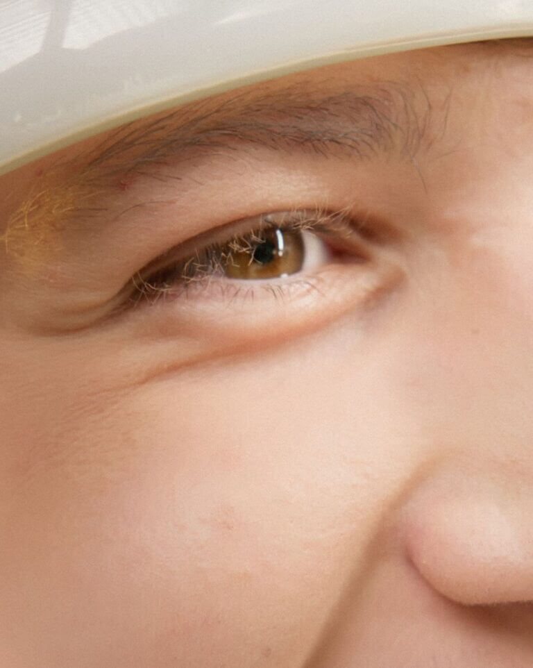 Phakic Intraocular Lens Implantation - What You Need To Know